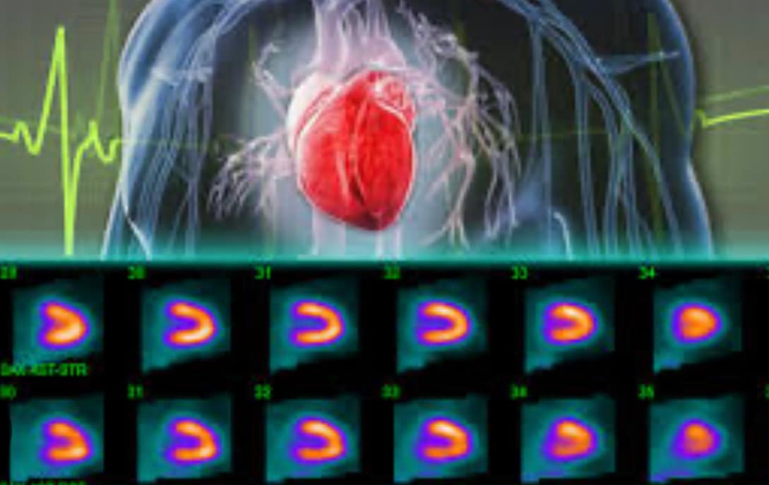 Premier Cardiovascular Consultants in Cleveland & Kingwood TX